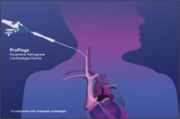 ProPlege Device – enableCV