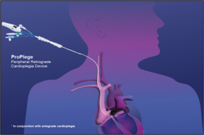 ProPlege Device – enableCV